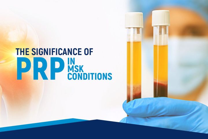 PRP for Joint Pain: A New Era in Musculoskeletal Treatment